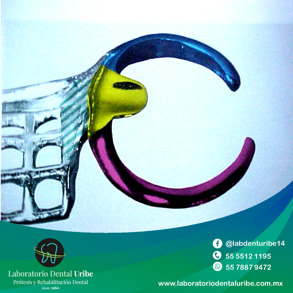 Retenedores directos en prótesis parcial removible - Página web de ...