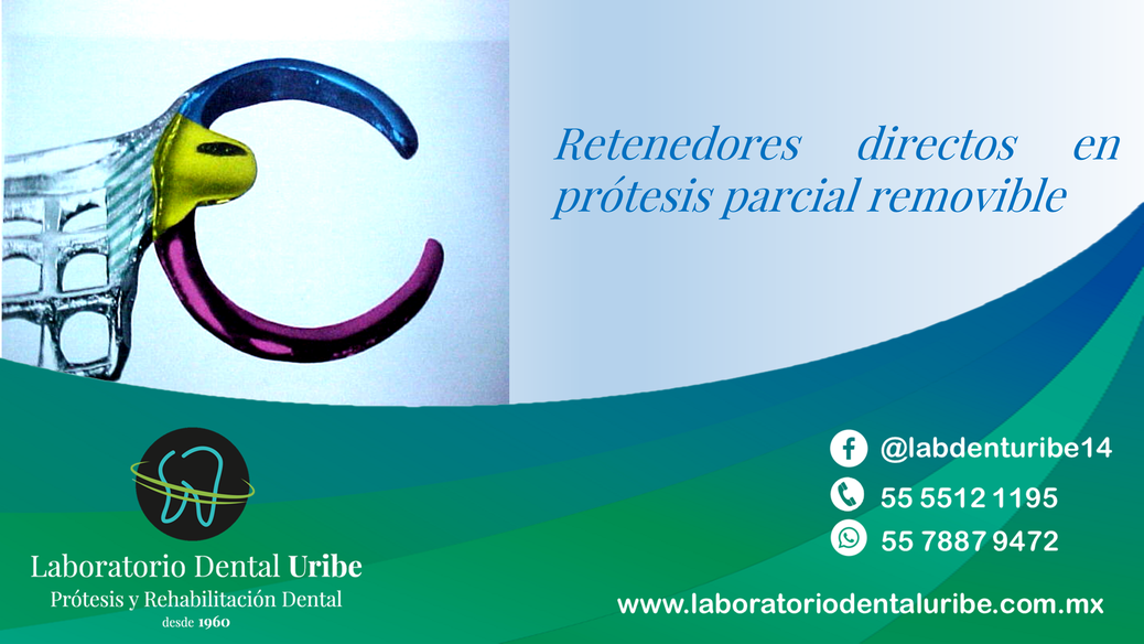 Retenedores directos en prótesis parcial removible - Página web de ...
