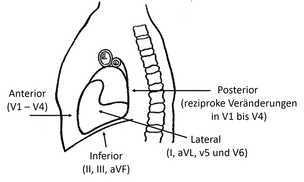 Wilson-Ableitungen - Fokus-EKG