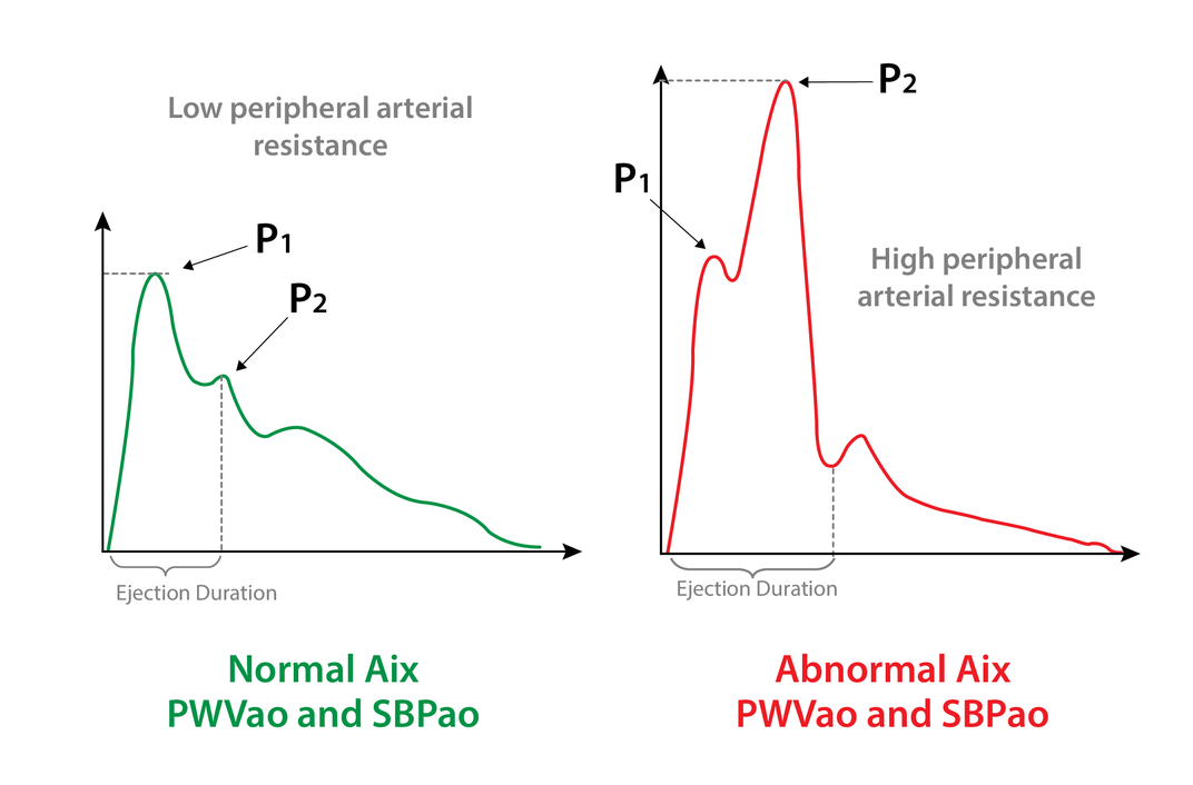 Arteriograph Company - Pulse Wave Analysis & Arterial Stiffness