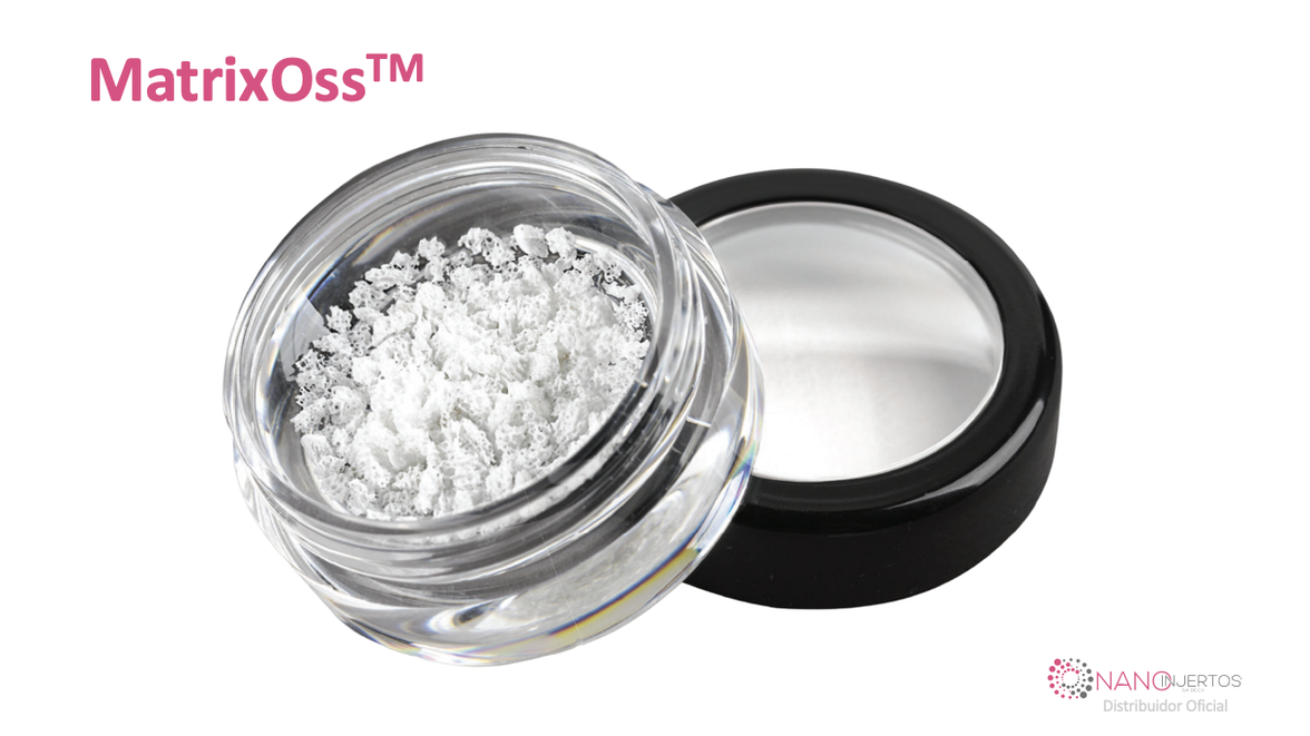 Injerto Óseo, Qué es, Cómo Funcionan, Cuál comprar en 2024 - Nano Injertos®