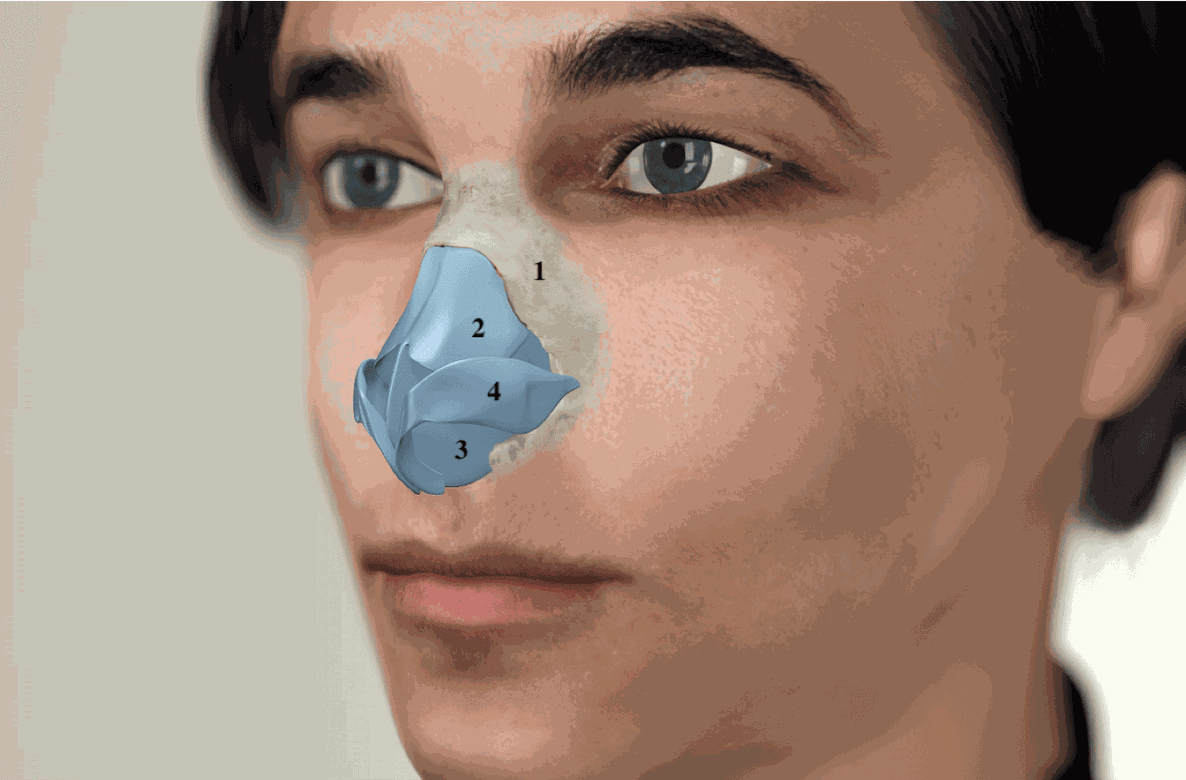 The structure of the nose - Dr. Kovacevic