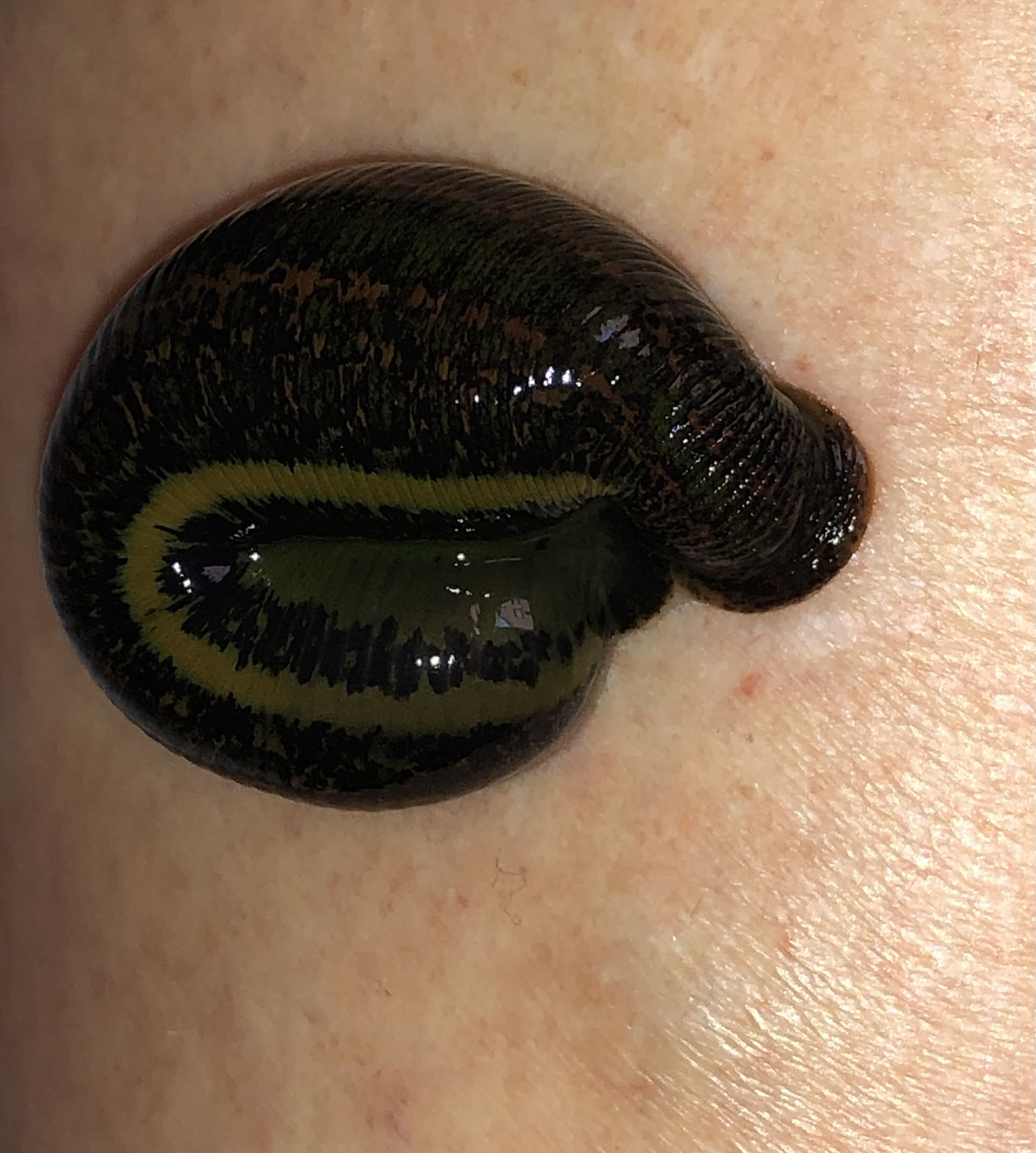 Blutegel-Therapie in Villingen-Schwenningen - Bianca Seitler