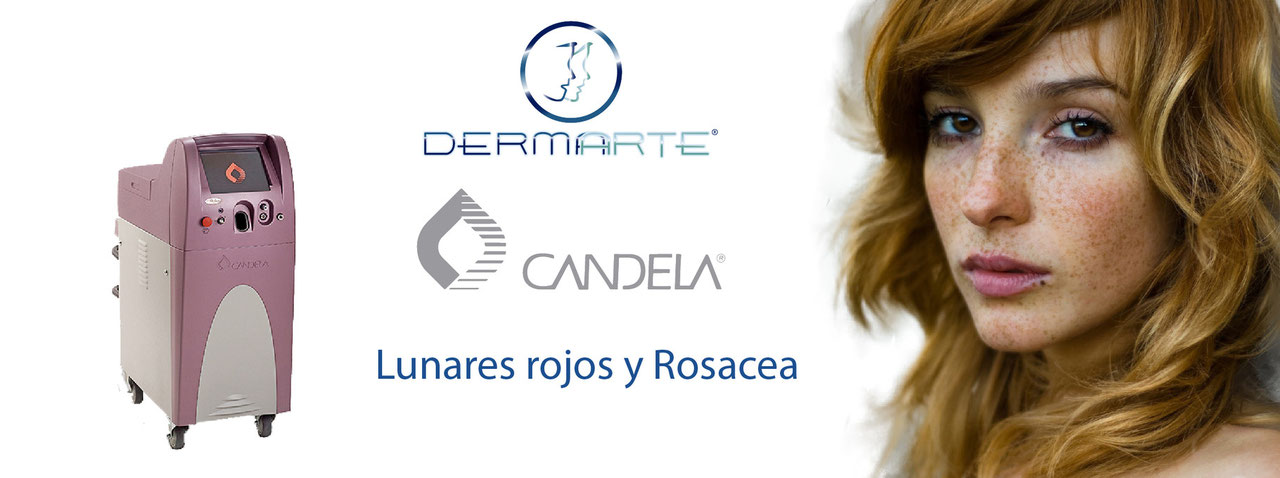 Láser colorante pulsado VBeam Candela - Dermatólogos Militares y Civiles.