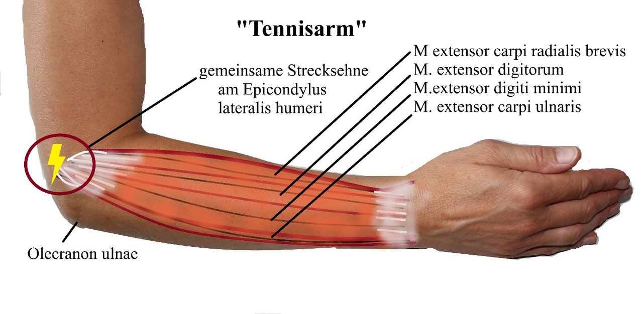 Region 1 Muskulatur, Sehnen, Weichteile - see-feel-treats Webseite!