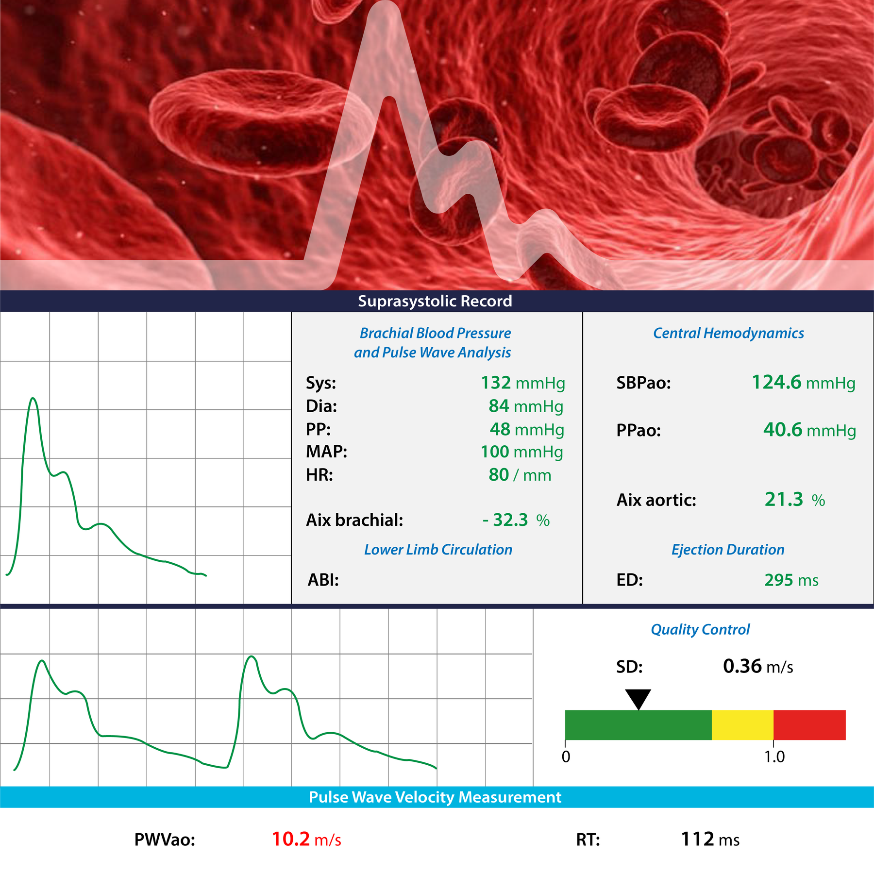 Arteriograph Company - Pulse Wave Analysis & Arterial Stiffness