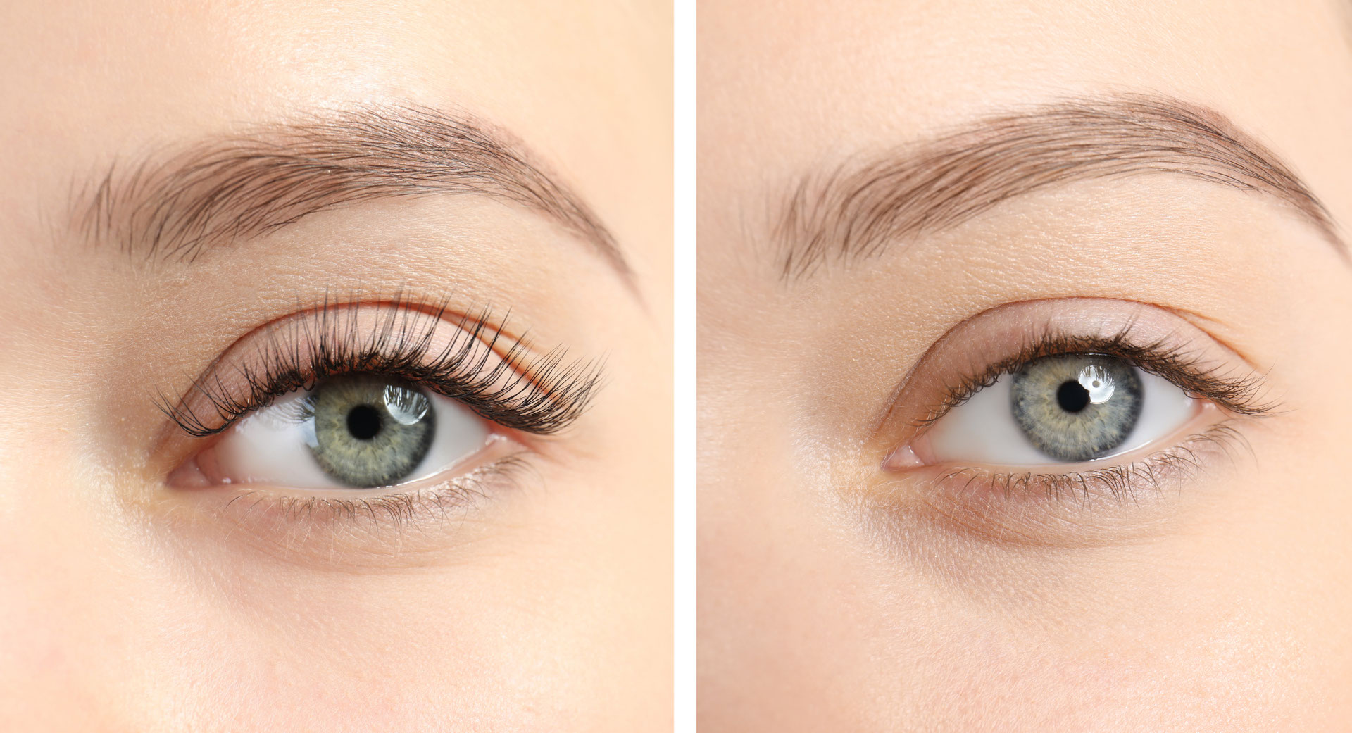 Wimpernlifting Vorher Nachher Bilder