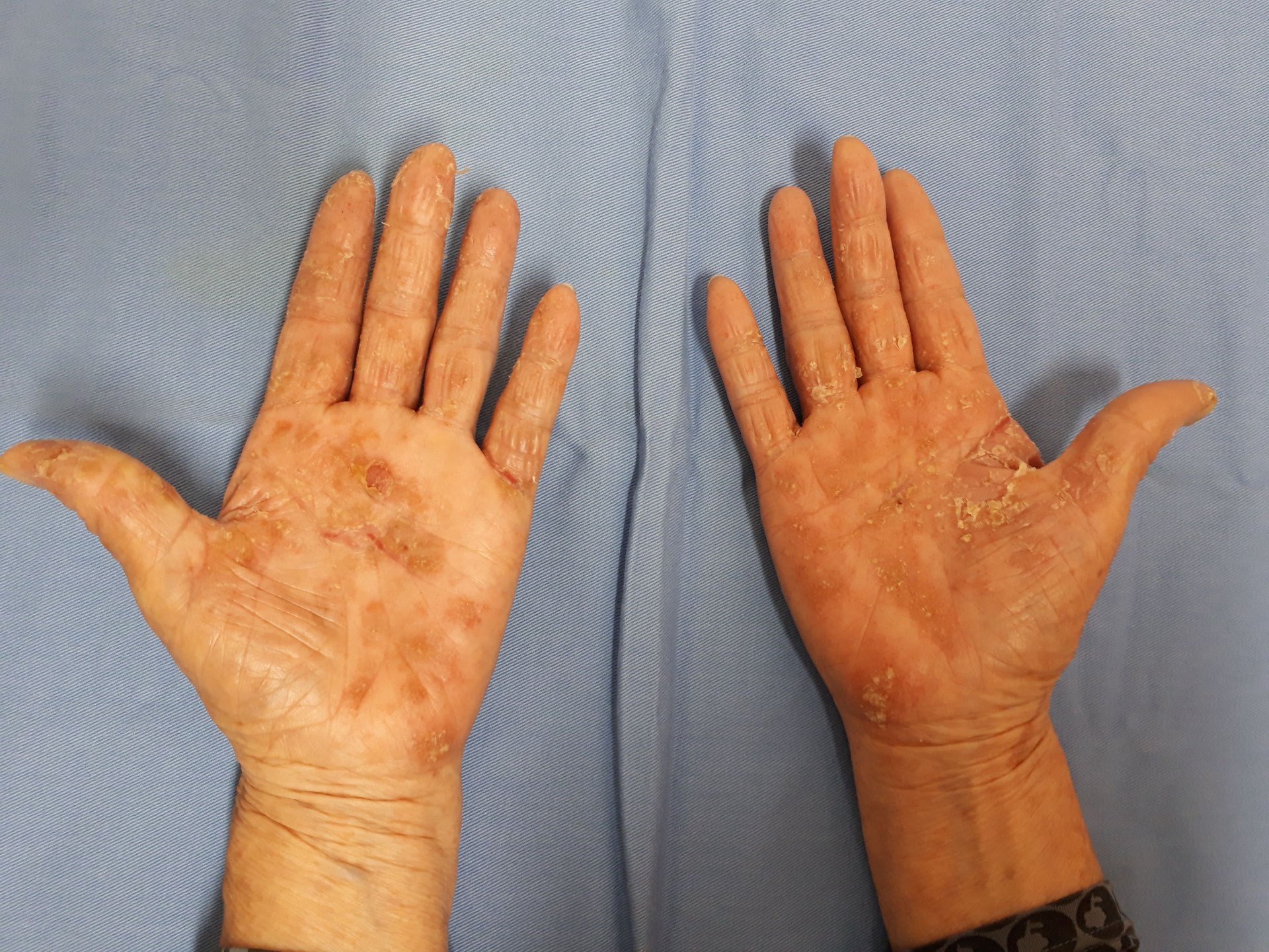 ホーム - mmc-refractory-skin-disease ページ！