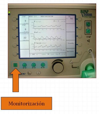 RESPIRADORES: - Página Jimdo de enfermeriaintensiva