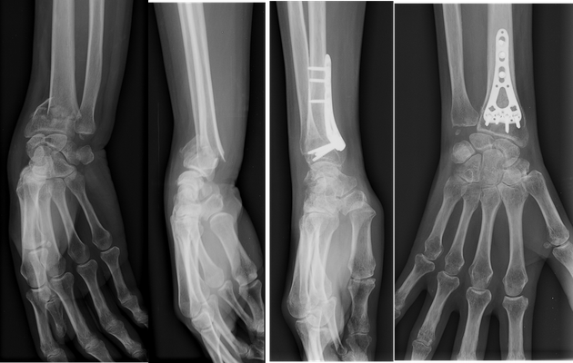 CHIRURGIE DU SPORT - Dr Rémi : chirurgien orthopédiste à Toulouse