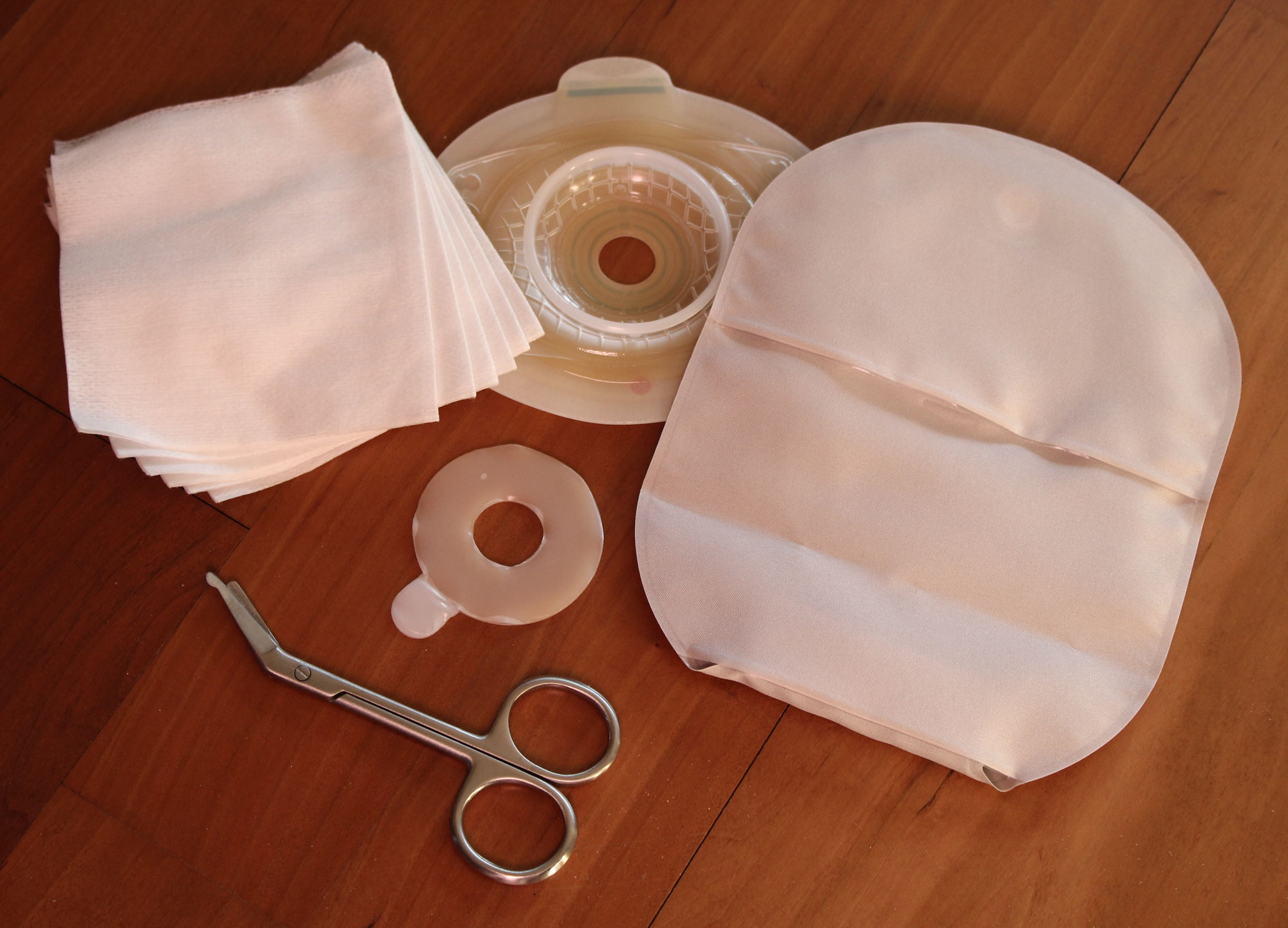 Stoma - Colitis Ulcerosa Blog