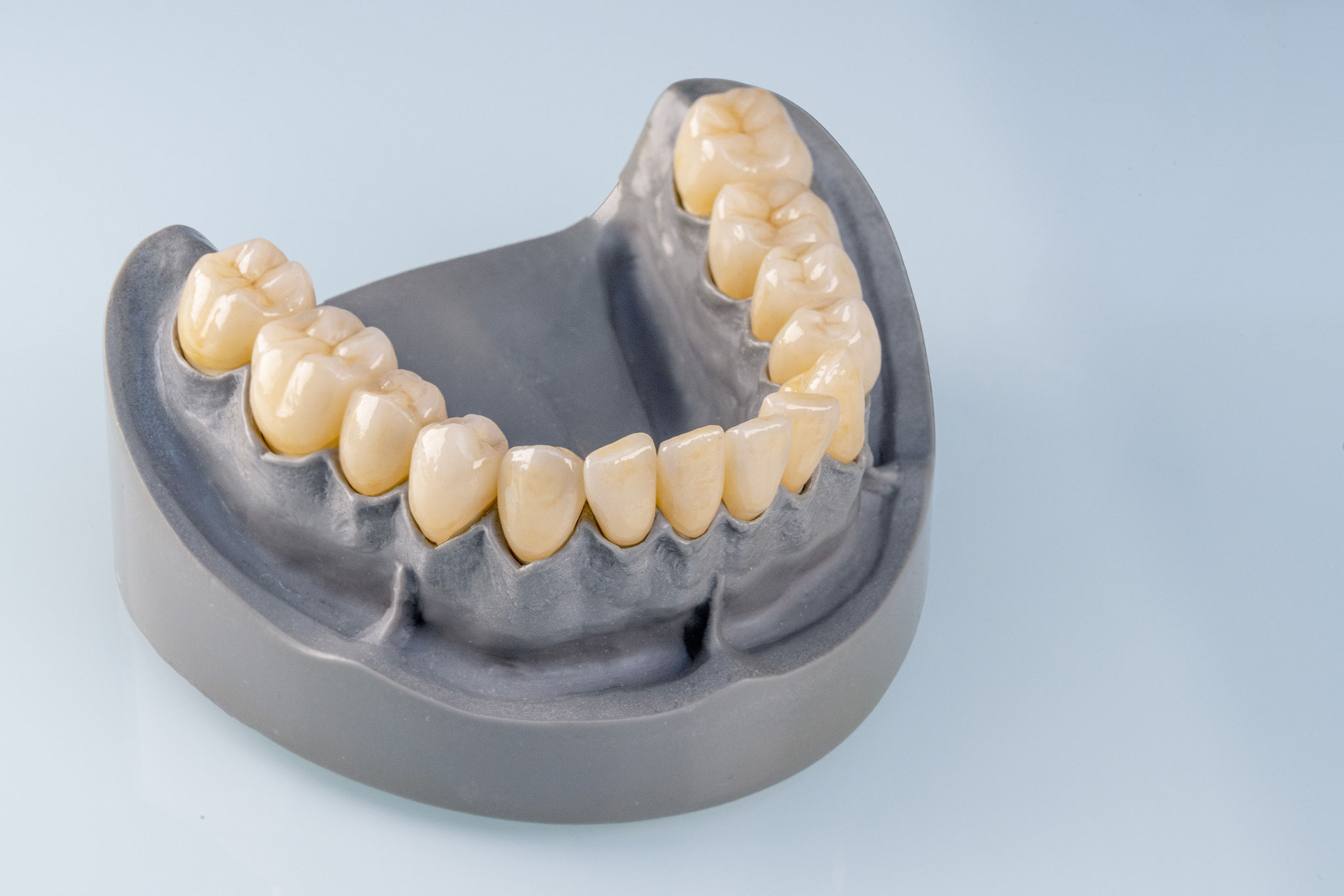 Kronen und Brücken – Völlig natürliche Ästhetik mit Vollkeramik ...