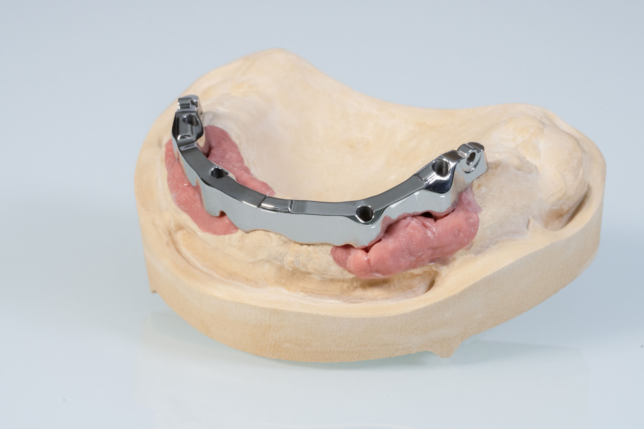 Total- und Hybridprothese – Vereinigung traditioneller Handwerkskunst ...