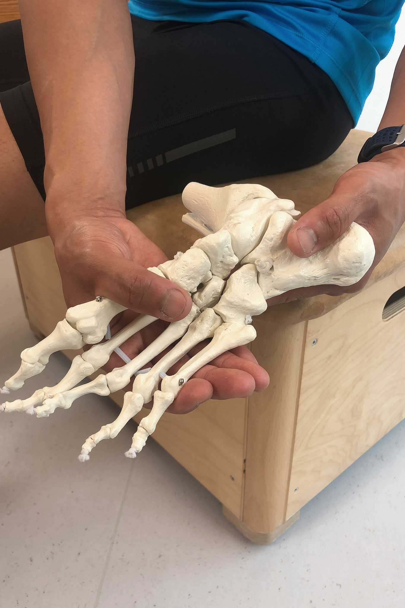 Spreizfuß - Dr. med. Matthias Marquardt