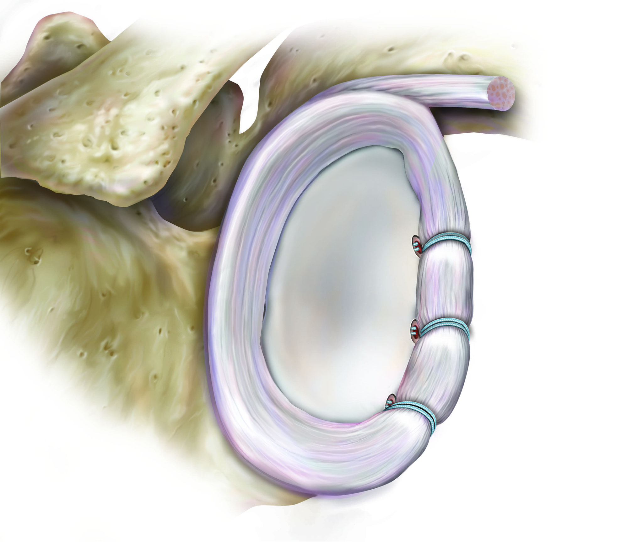 Schulterluxation und Labrumläsion - SPORTCHIRURGIE Heidelberg