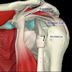 Rotator Cuff letsels - De schouderkliniek Oudenaarde (Vlaamse Ardennen ...