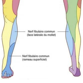 Compression du nerf sciatique poplité externe (SPE) - PRO-TMS