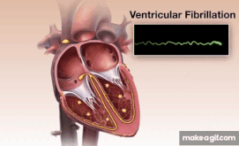 Desfibrilador - AprendEmergencias