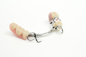 Zahnersatz - herausnehmbare Prothesen auf Zähnen und Implantaten ...