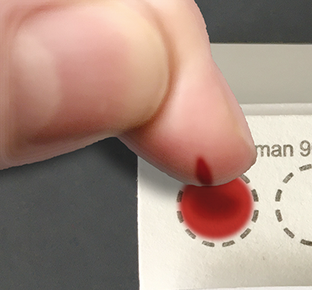 i.Mune TBNK (CE) - EPIMUNE