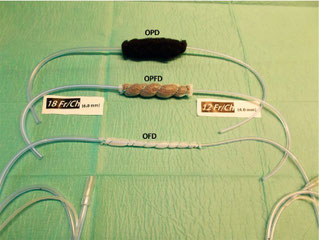 Endoscopic vacuum therapy in upper GI-tract "Fistulas ...