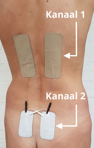 Veilige pijnbestrijding bij bevalling? - Mammatens