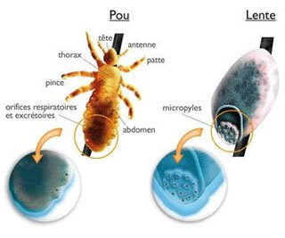 C'est quoi un pou ? - Site Jimdo de dpe 76