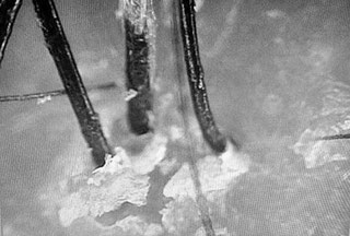 la peau, le cuir chevelu - Site de bvcoiftec