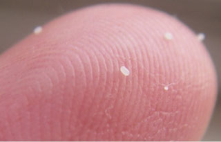 Les oeufs de puces et autres stades immatures : FAQ 2024 sur les Puces ...