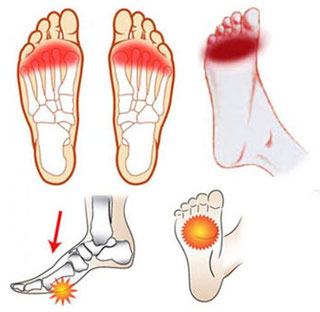 Hallux Operation - Fuss-Praxis Bern