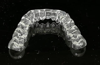 Knirscherschienen - Dentaltechnik Ostertag