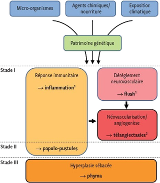 acné rosacée - bettymasure-naturopathe-Nantes