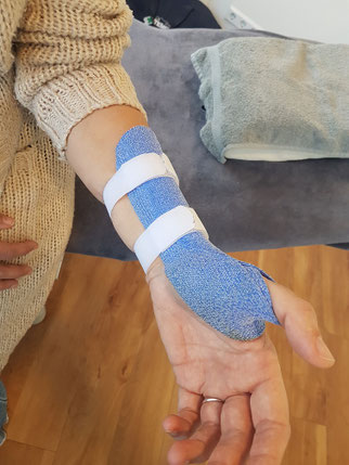 Spalktherapie bij hand-pols klachten - Fysio in Motion