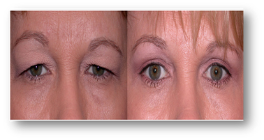 Fibroblaster - mariaegglers Webseite!