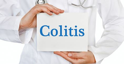 ALIMENTOS A EVITAR SI TIENES COLITIS - Dra. Rivera, sistema digestivo ...