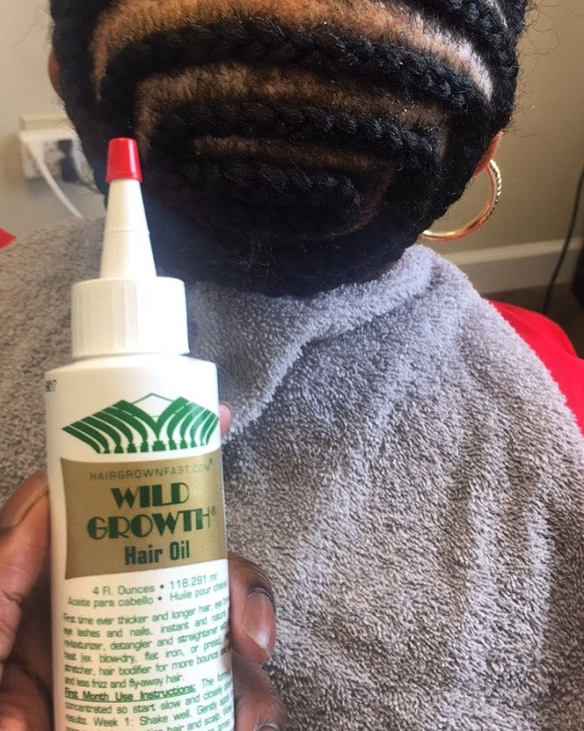 Winter Scalp Care - Braids By Kia