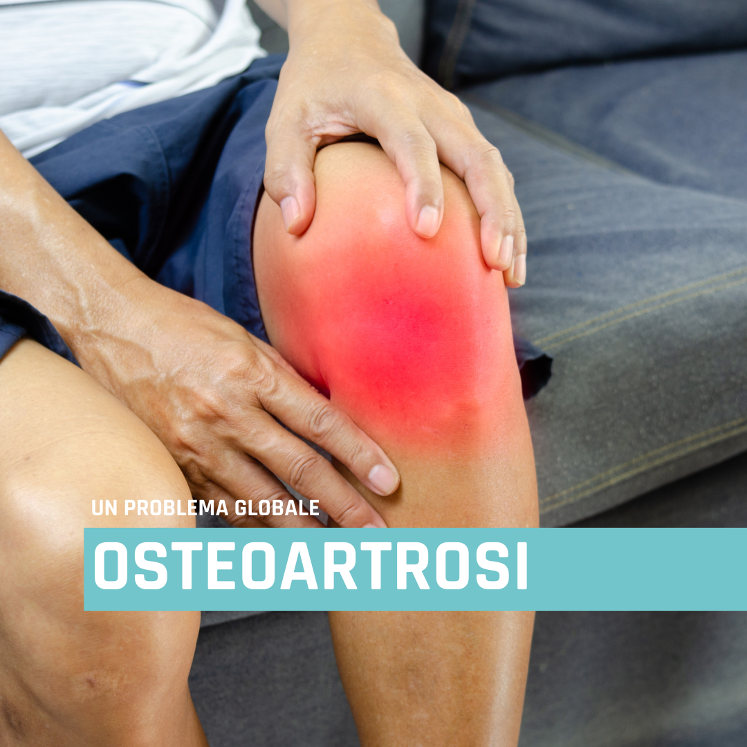 OSTEOARTROSI: UN PROBLEMA GLOBALE - PhysioLab Chiavari