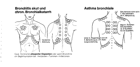- Behandlung des Asthma - bronchiale - Naturheilpraxis Michael M. Kastner