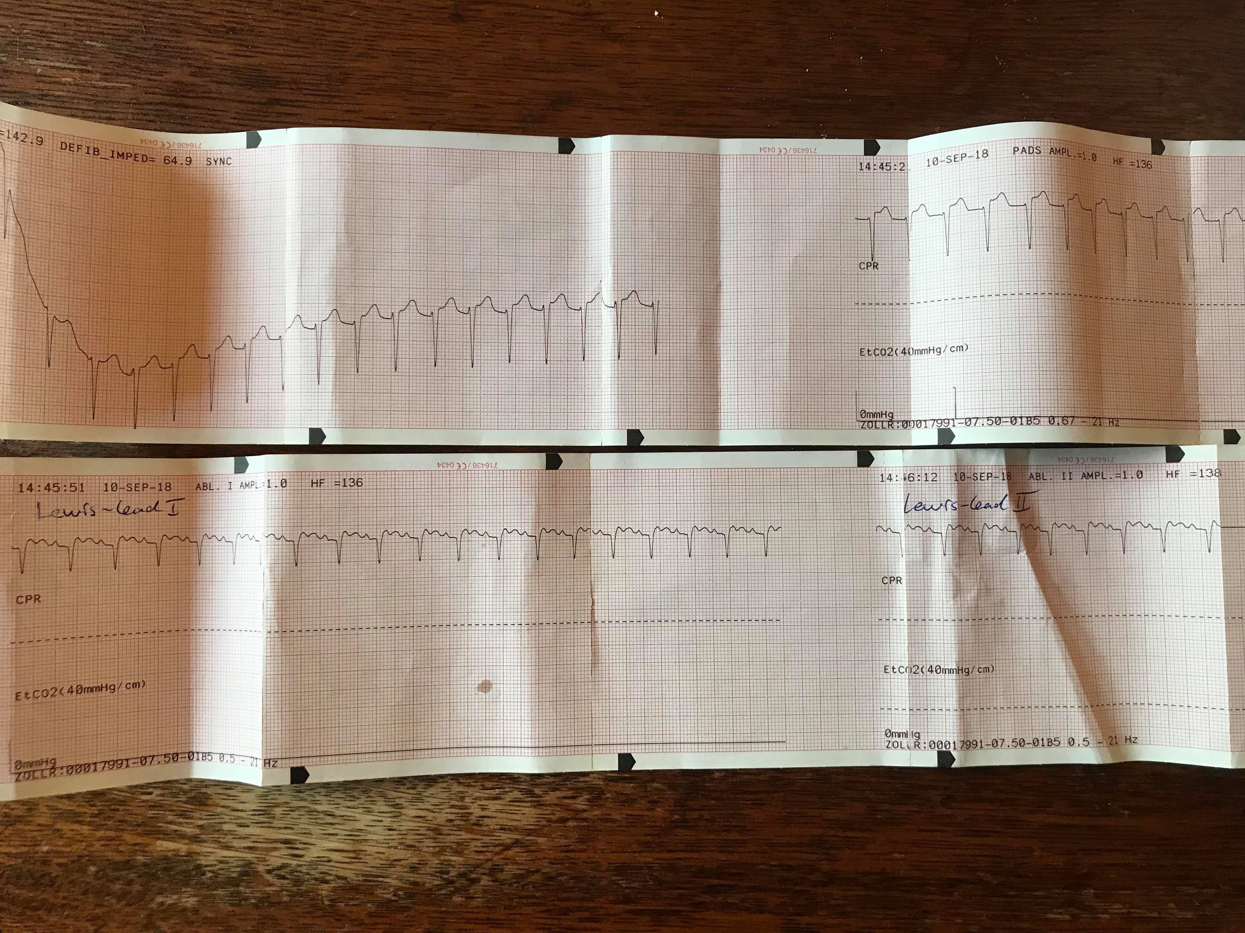 Danke an #dasFOAM - Lewis-Lead funktioniert - passion-notfallmedizins ...