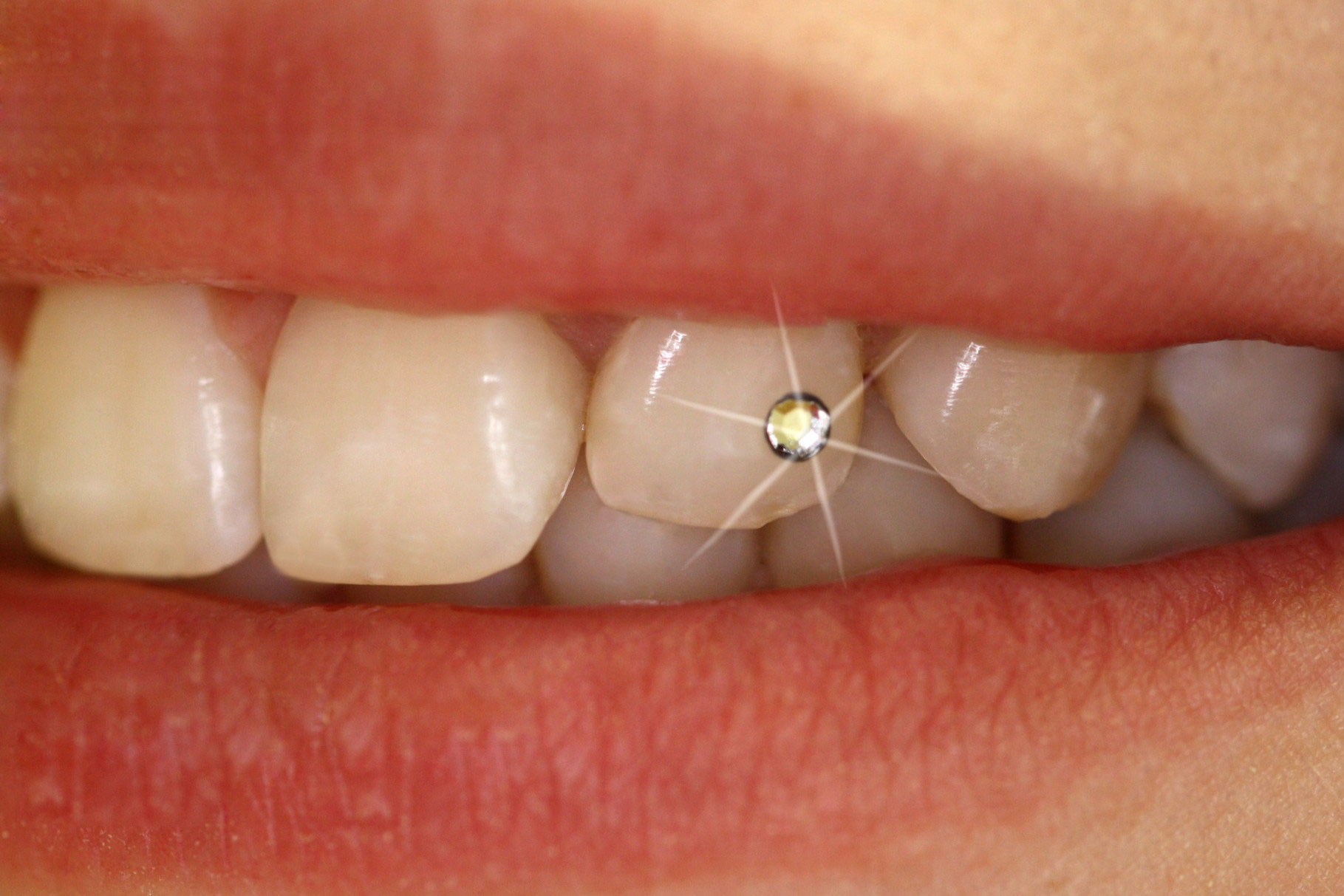 Zahnschmuck - zahnarzt-mitrovics Webseite!