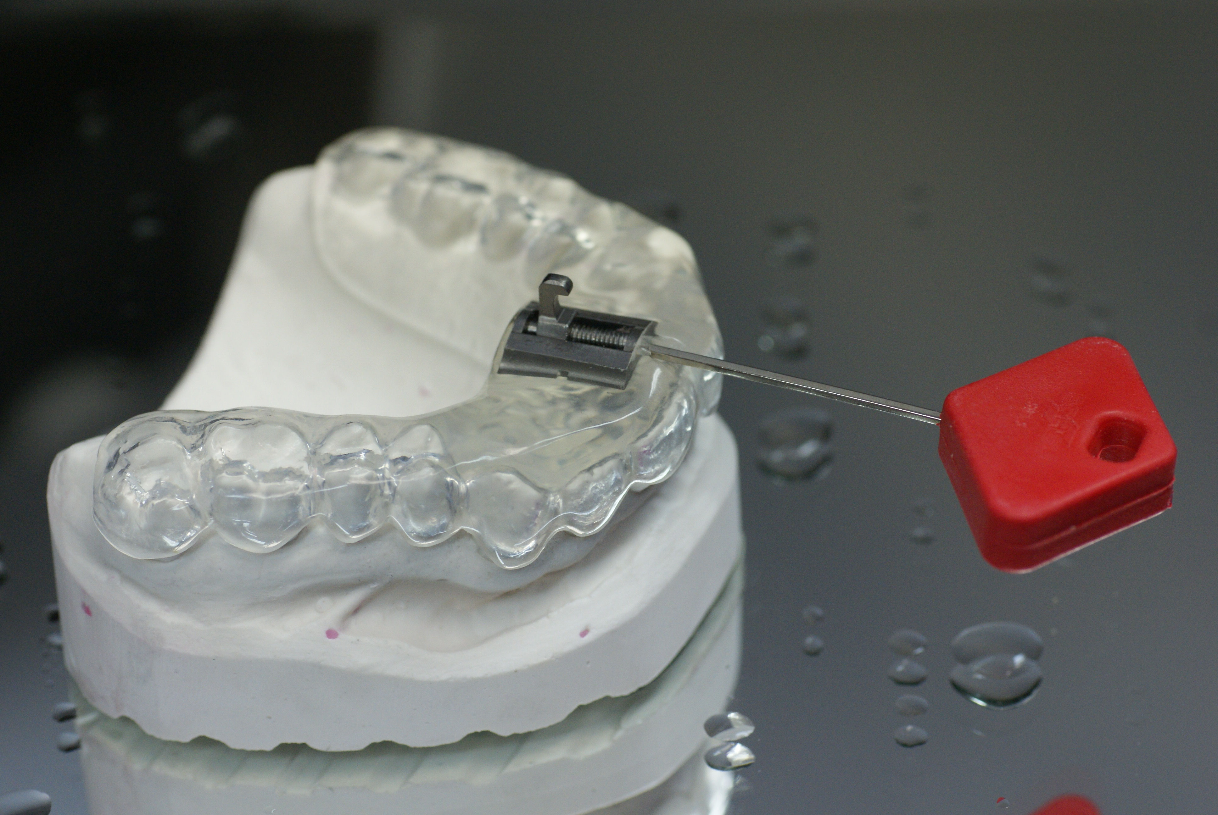 TAP*-Protrusionsschiene - Meisterlabor für dentale Ästhetik