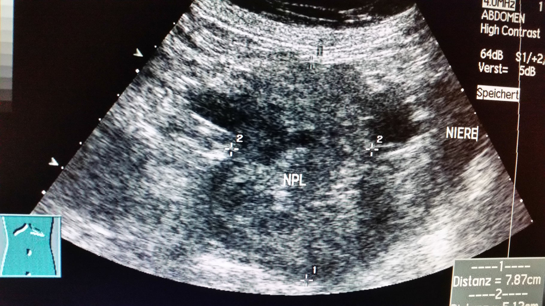 Sono Story 81 - sono4students-stuttgarts Webseite!