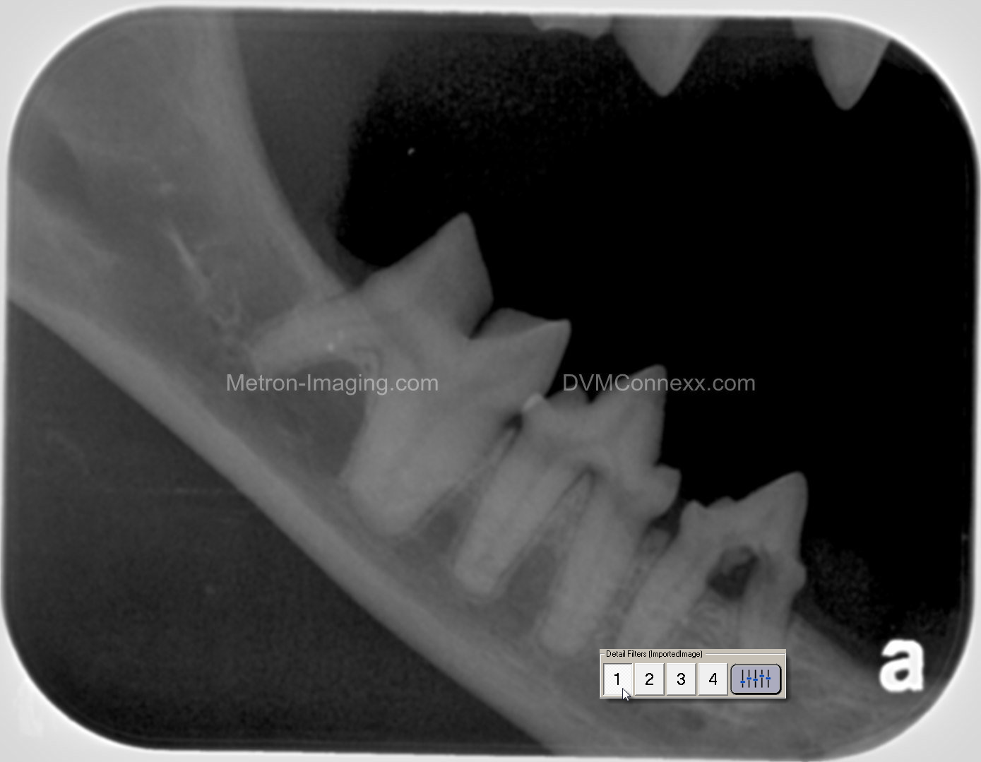 Filters Used In X Ray