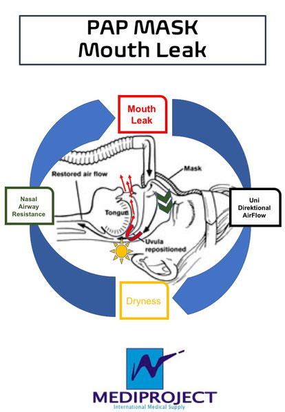 Mouth Leak Circle - mediprojecteus Webseite!
