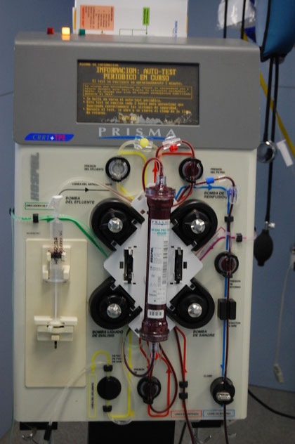 Hemodiálisis: - Página Jimdo de enfermeriaintensiva