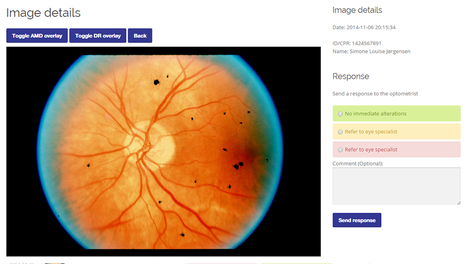 Fundus Scanner - Der Optik Filbert