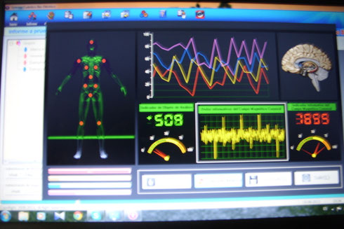 Scanner Cuántico Biomagnetico - Página Jimdo de psximenacvasquezjones
