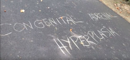 CAH（先天性副腎過形成）とは？ - cahsupport ページ！