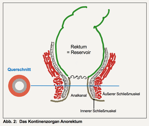 Experteninterview: Stoma Rückoperation - Kontinenzblog Pelvipedia