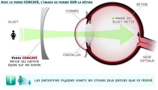 Partie I : de l'oeil au cerveau : quelques aspects de la vision - Site ...